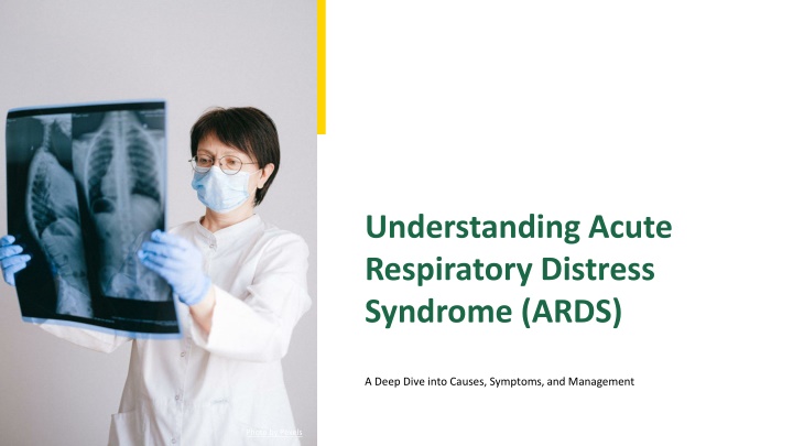 PPT - Deep Dive into Acute Respiratory Distress Syndrome (ARDS): Causes ...